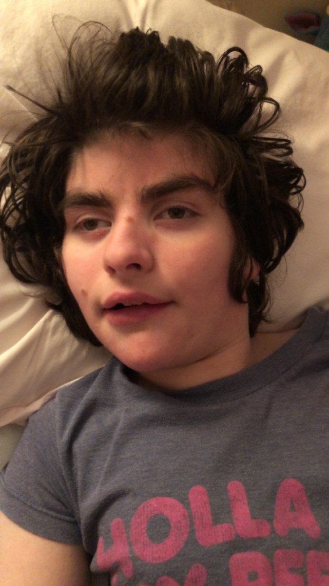 Grace: Miller-Dieker Syndrome, Lissencephaly with Podcast – Blue Skies ...